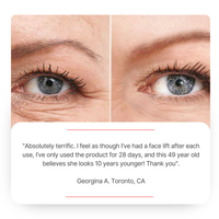 La Lumiere Rouge | Lumiere Rouge Light Therapy | Lumiere Rouge | Red ...